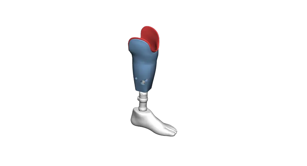 Prosthetic Socket | Wako3d